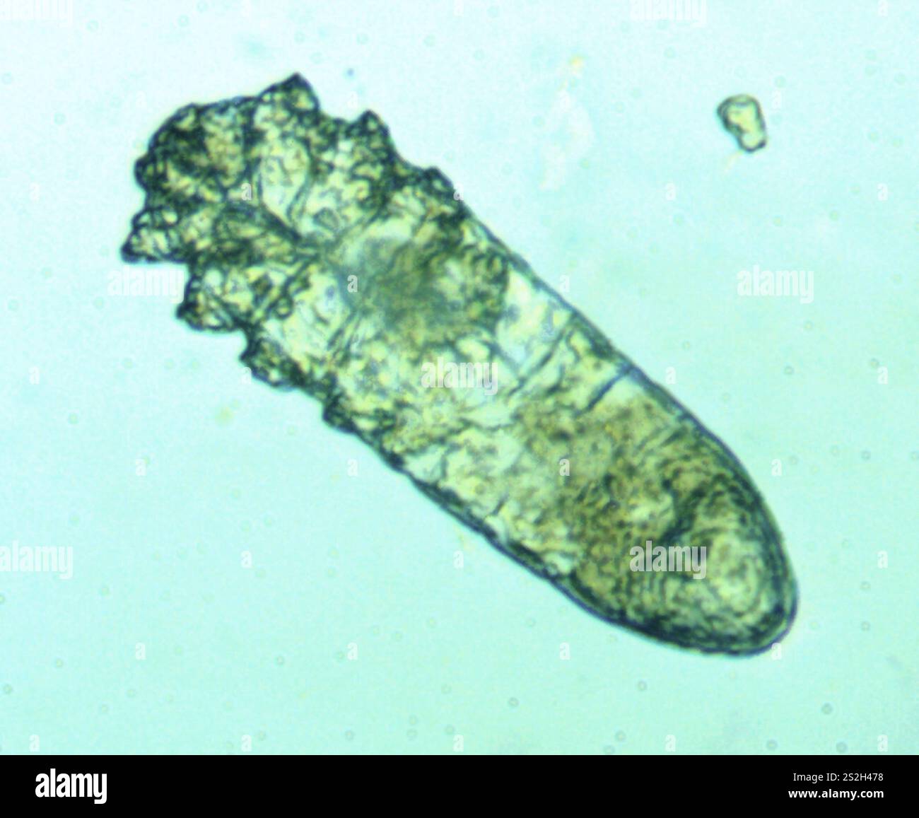 Mammalian Follicle Mites (Demodecidae Stock Photo - Alamy