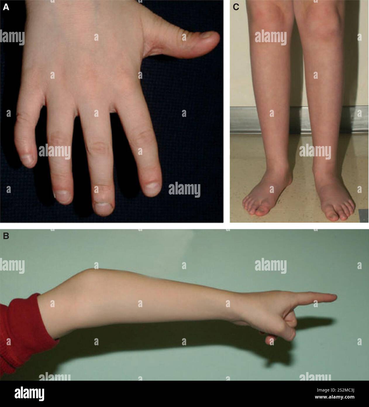 Fifth digit hi-res stock photography and images - Alamy