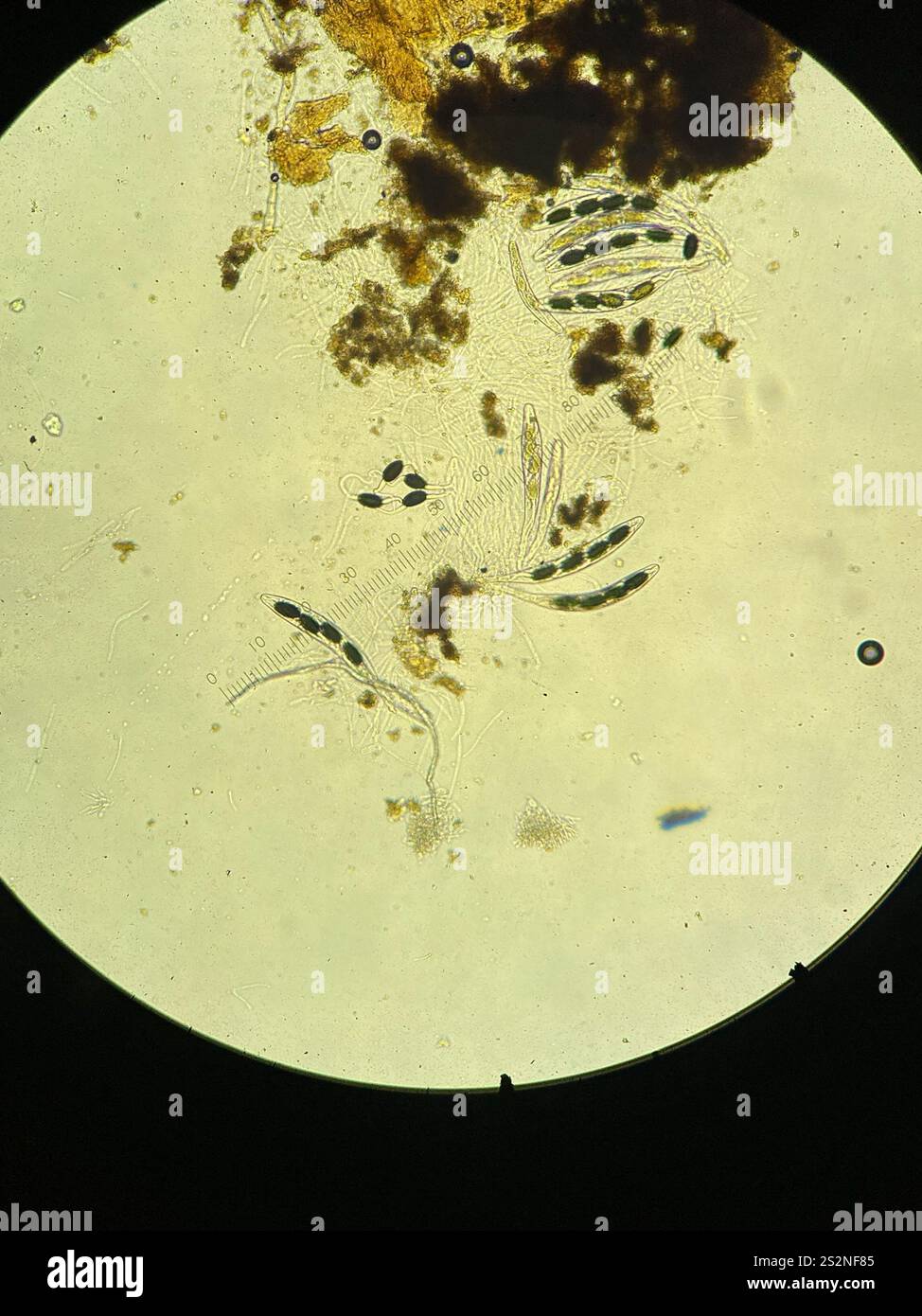 Podospora anserina hi-res stock photography and images - Alamy