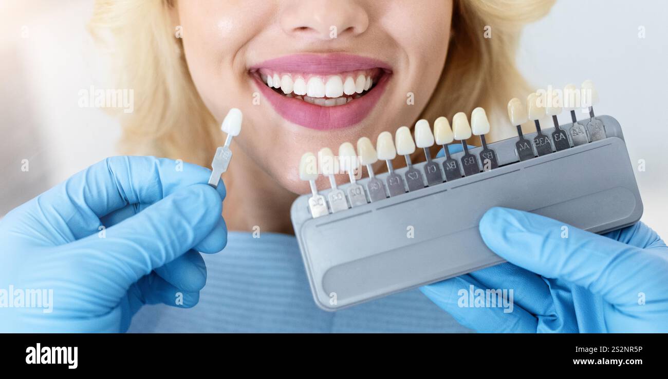 Dentist applying sample from tooth scale to happy patient teeth Stock ...
