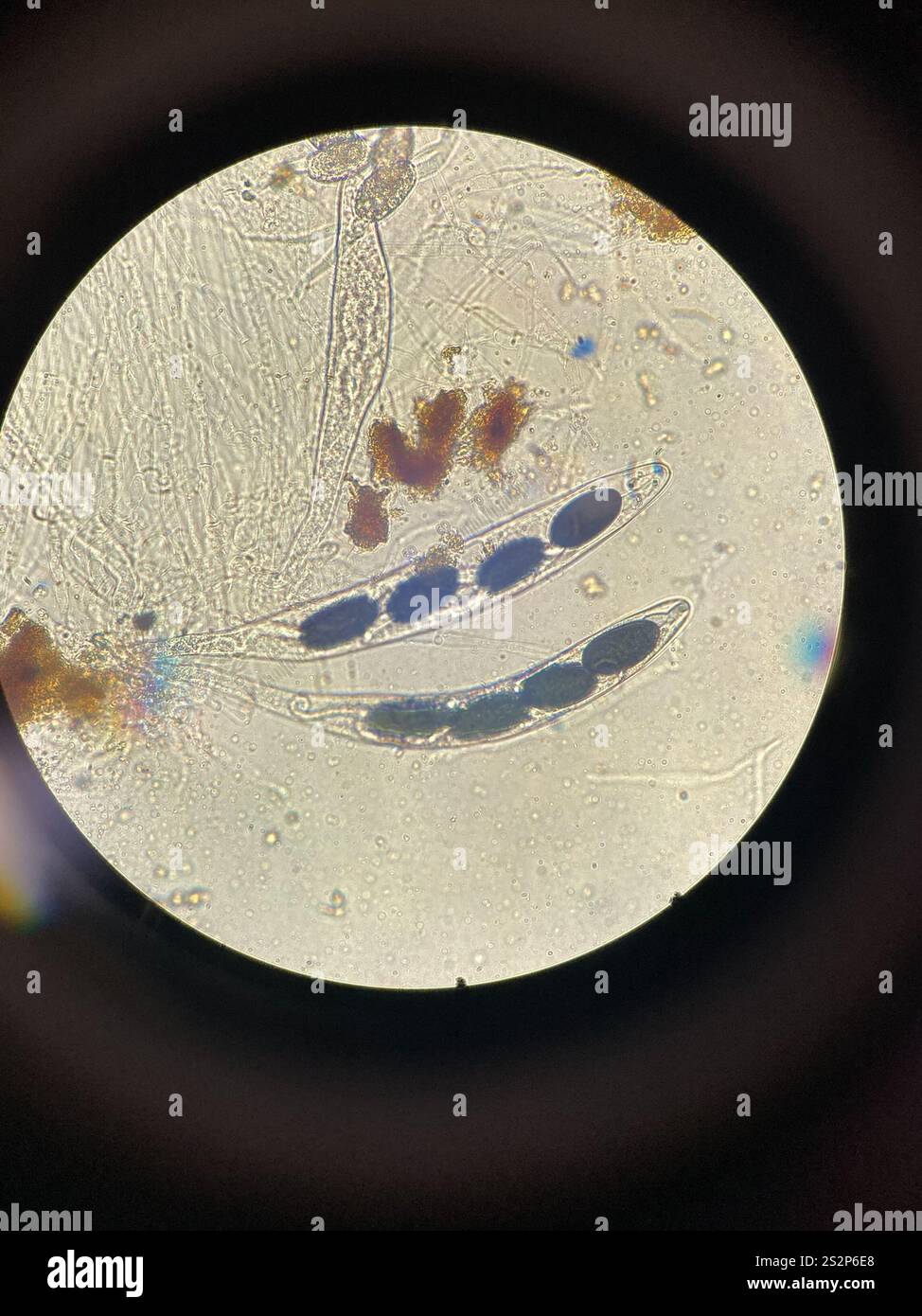 Podospora anserina hi-res stock photography and images - Alamy