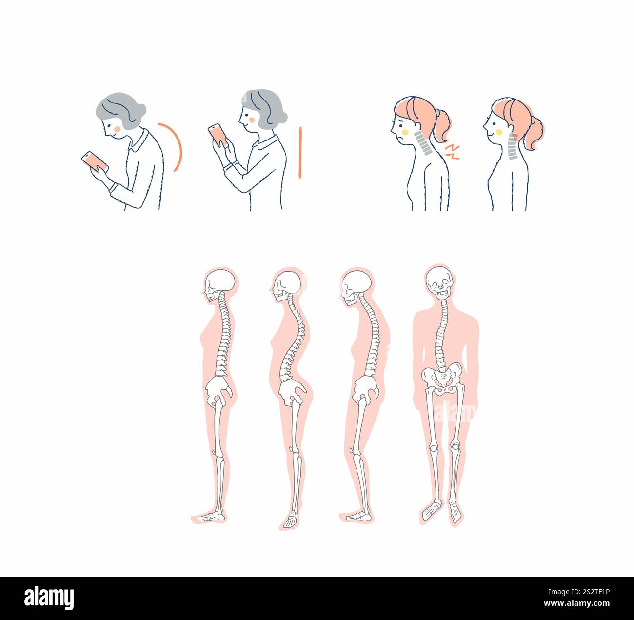 Correct and incorrect posture Straight neck Stock Photo - Alamy