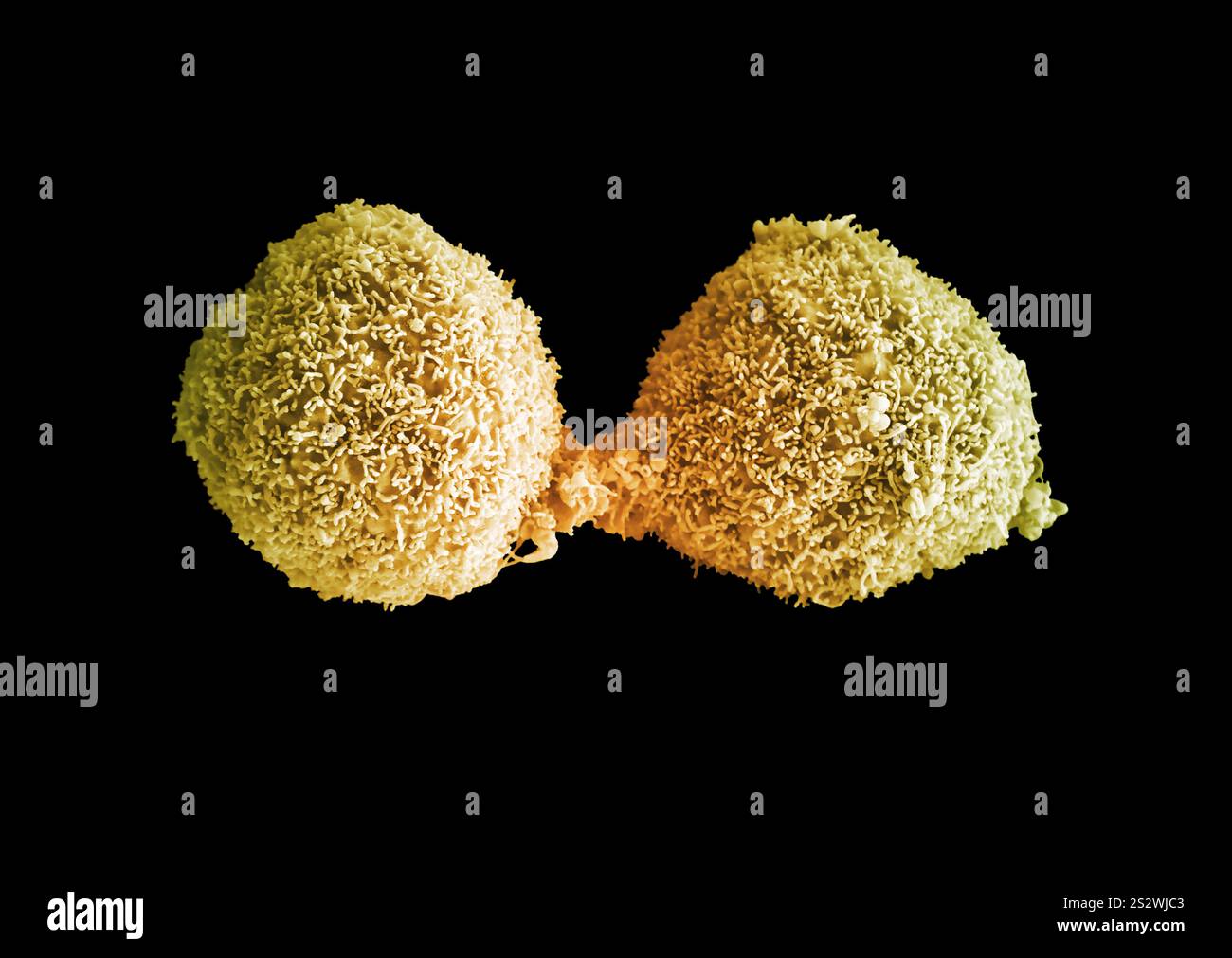 Lung cancer cells dividing, SEM Stock Photo - Alamy