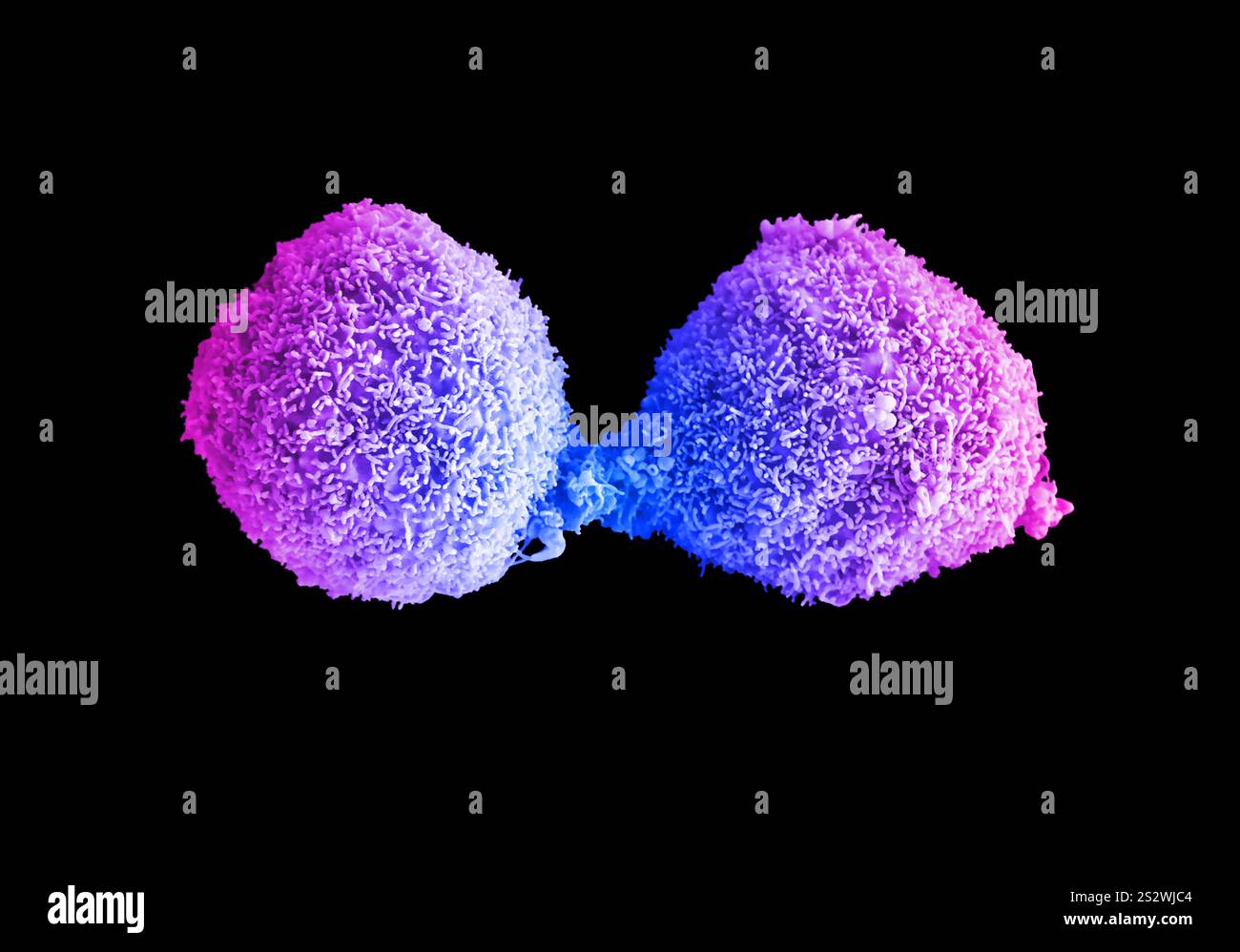 Lung cancer cells dividing, SEM Stock Photo - Alamy