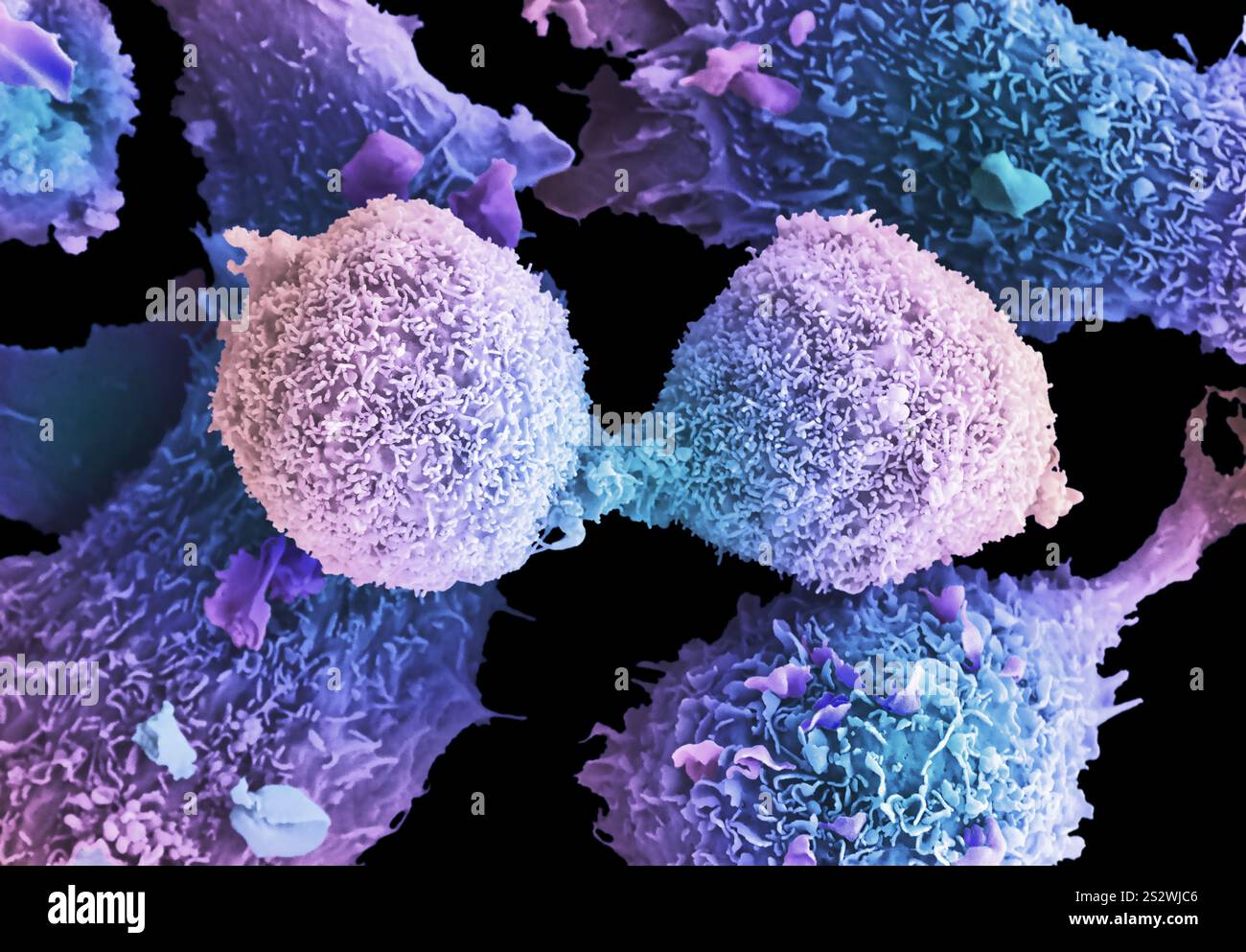 Lung cancer cells dividing, SEM Stock Photo - Alamy