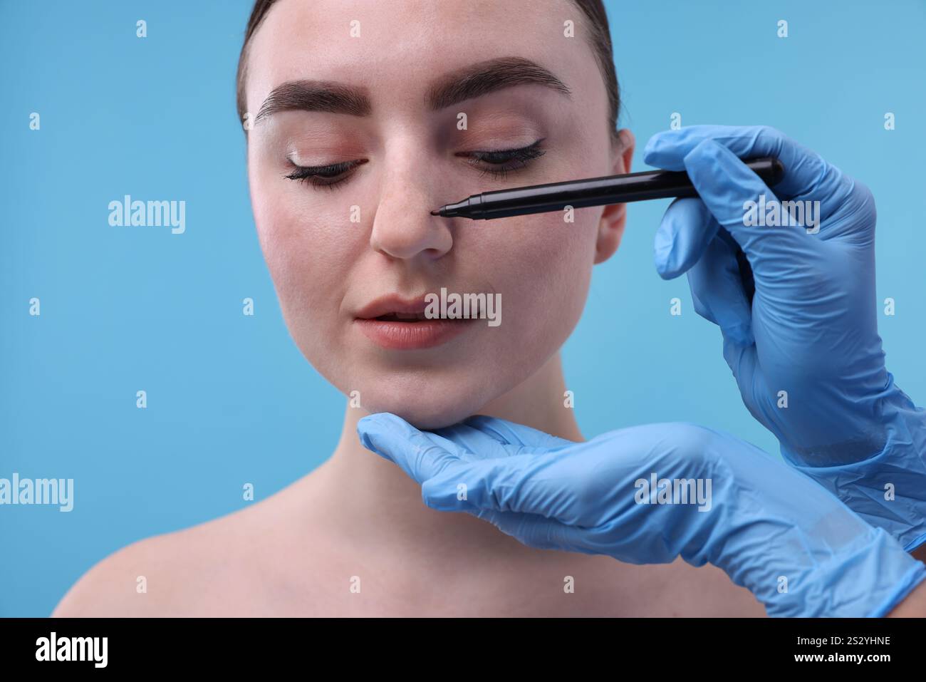 Doctor drawing marks on patient's nose for plastic surgery operation ...