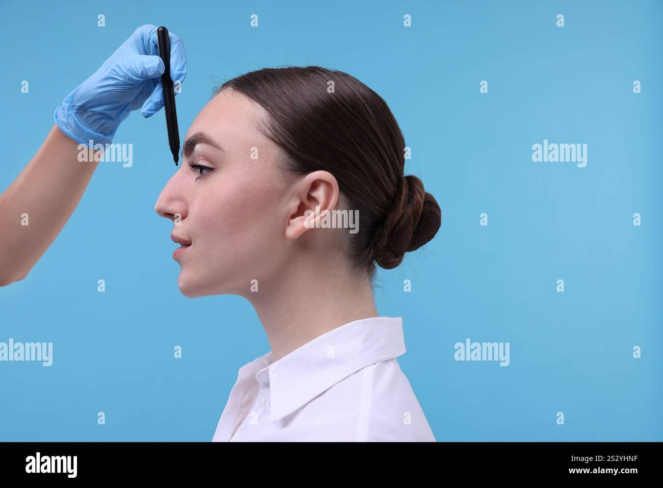 Doctor drawing marks on patient's nose for plastic surgery operation ...