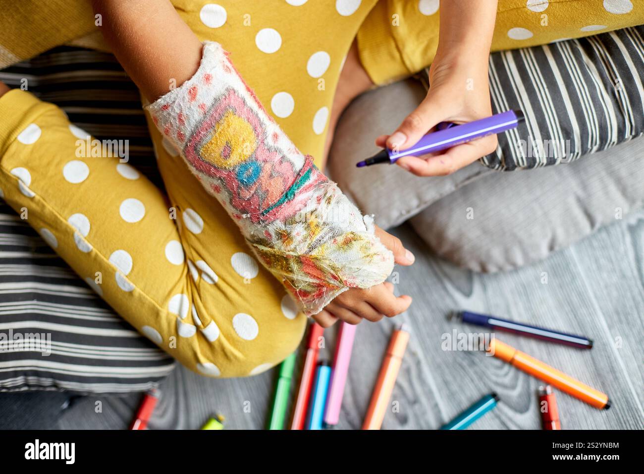 Teen girl with a broken arm at home draws an orthopedic cast, casted ...
