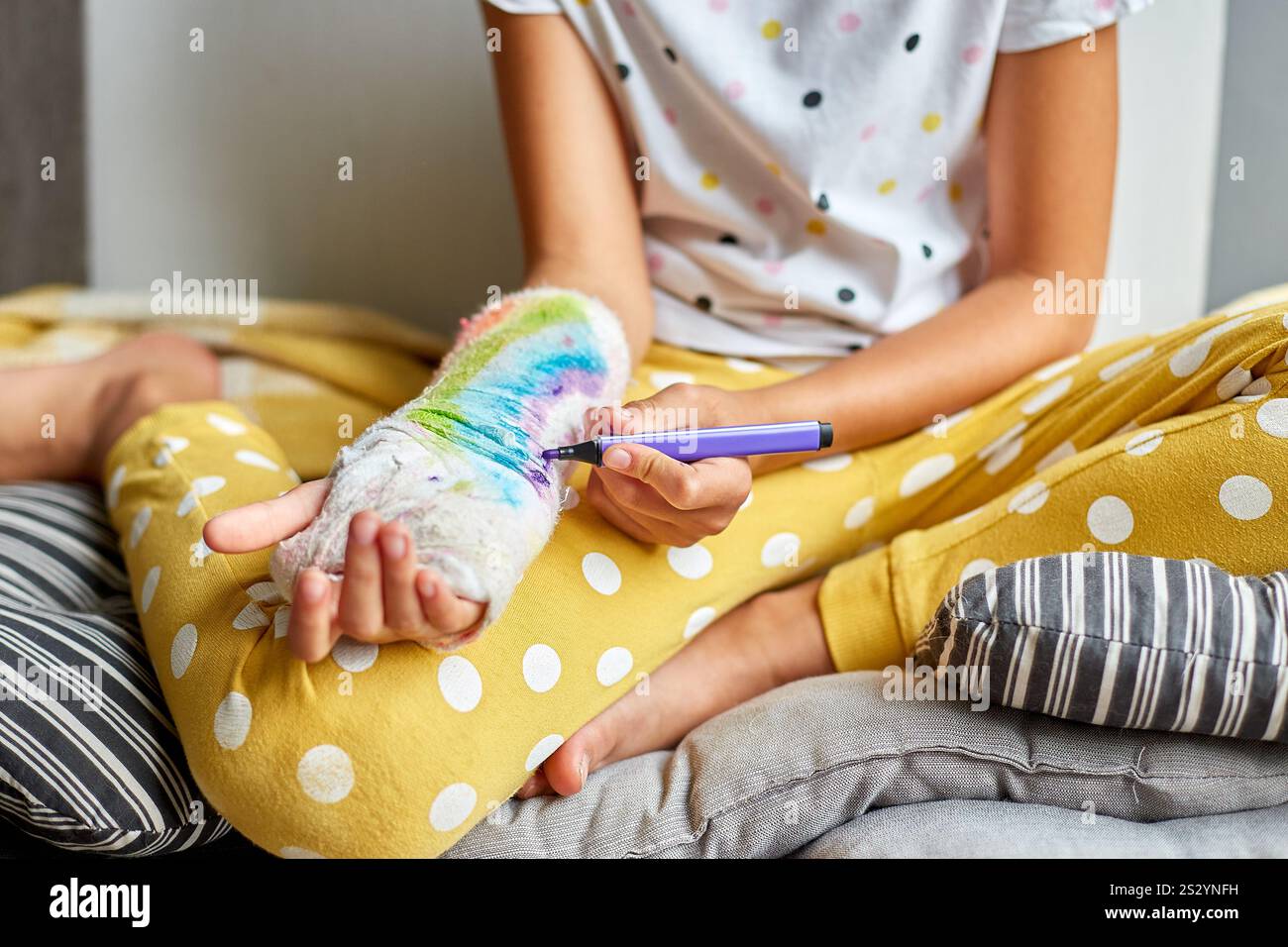 Teen girl with a broken arm at home draws an orthopedic cast, casted ...