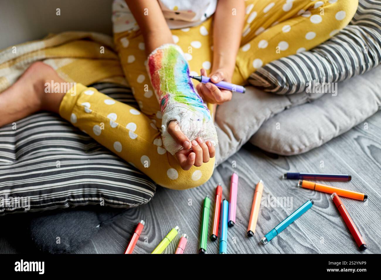 Teen girl with a broken arm at home draws an orthopedic cast, casted ...