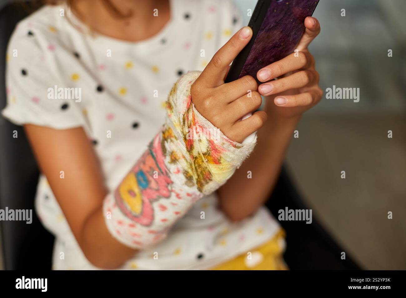 Teen girl with a broken arm orthopedic cast use smartphone, play or ...