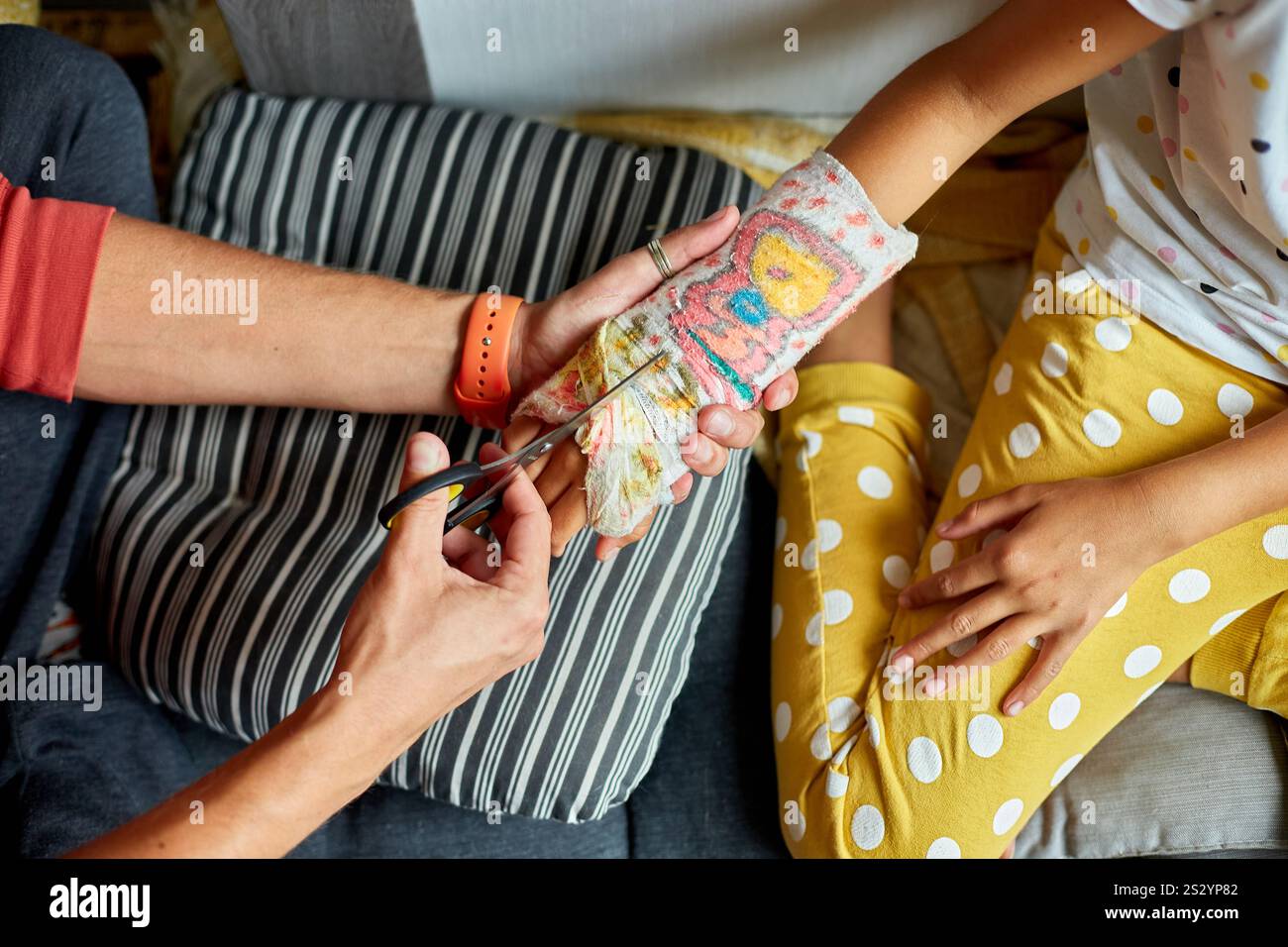 Father removing a plaster cast teen girl with a broken arm orthopedic ...