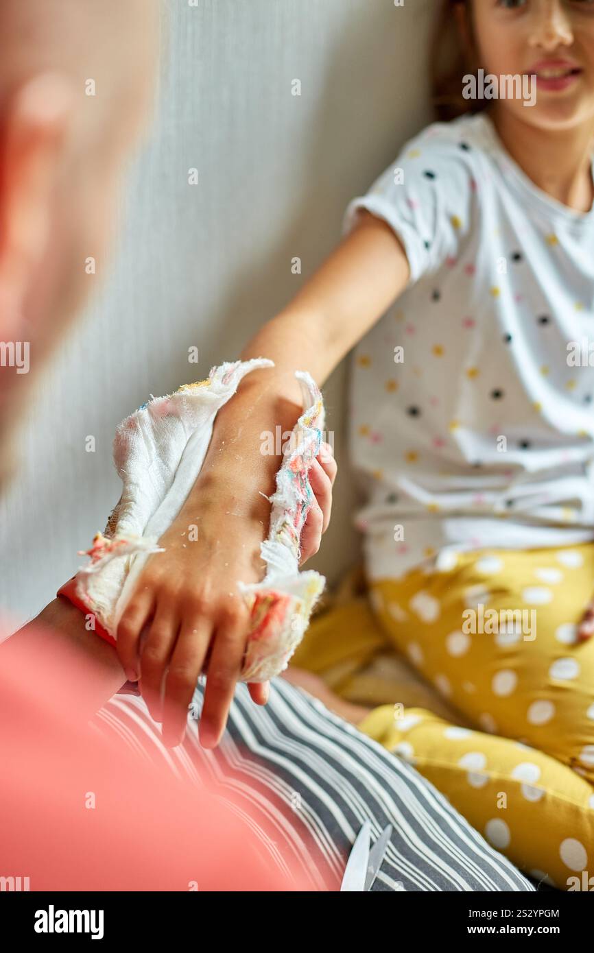Father removing a plaster cast teen girl with a broken arm orthopedic ...