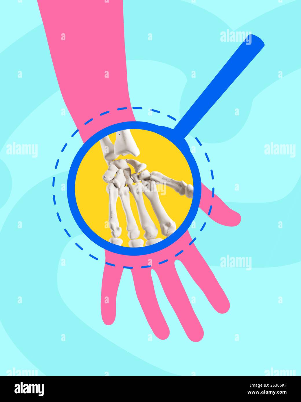 Magnified view of hand bones overlaid on bright abstract medical-themed ...