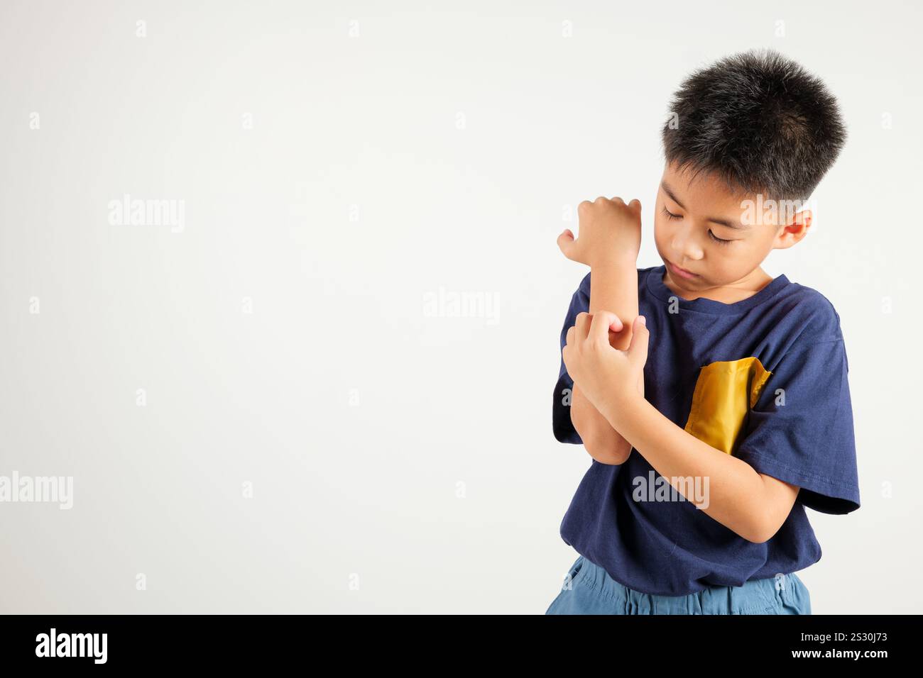 Asian little kid boy scratching itchy arm from a mosquito bite at ...