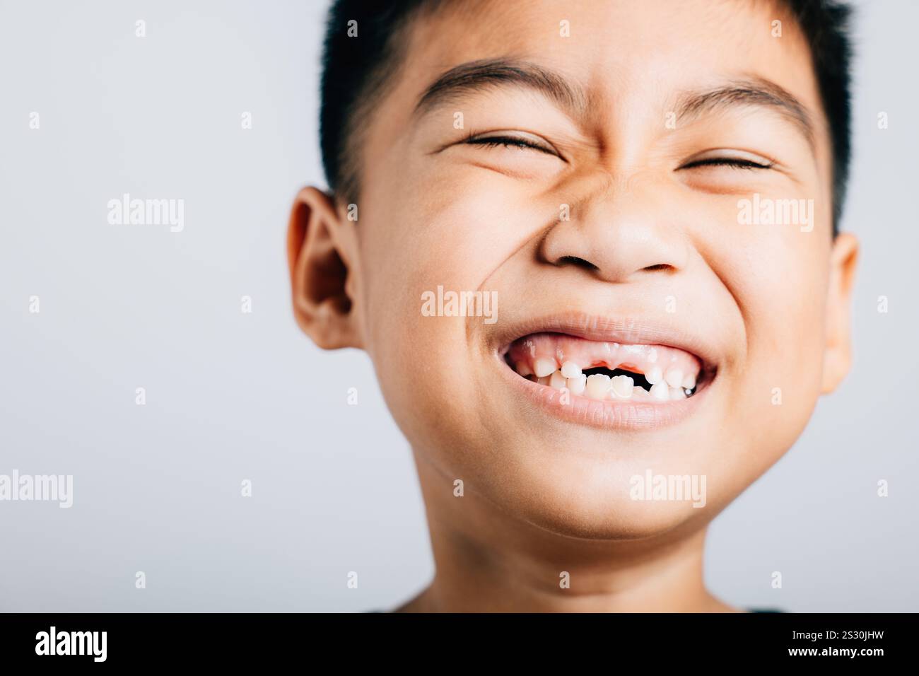 Smiling schoolboy tooth lost gap shows. Child isolated portrait on ...