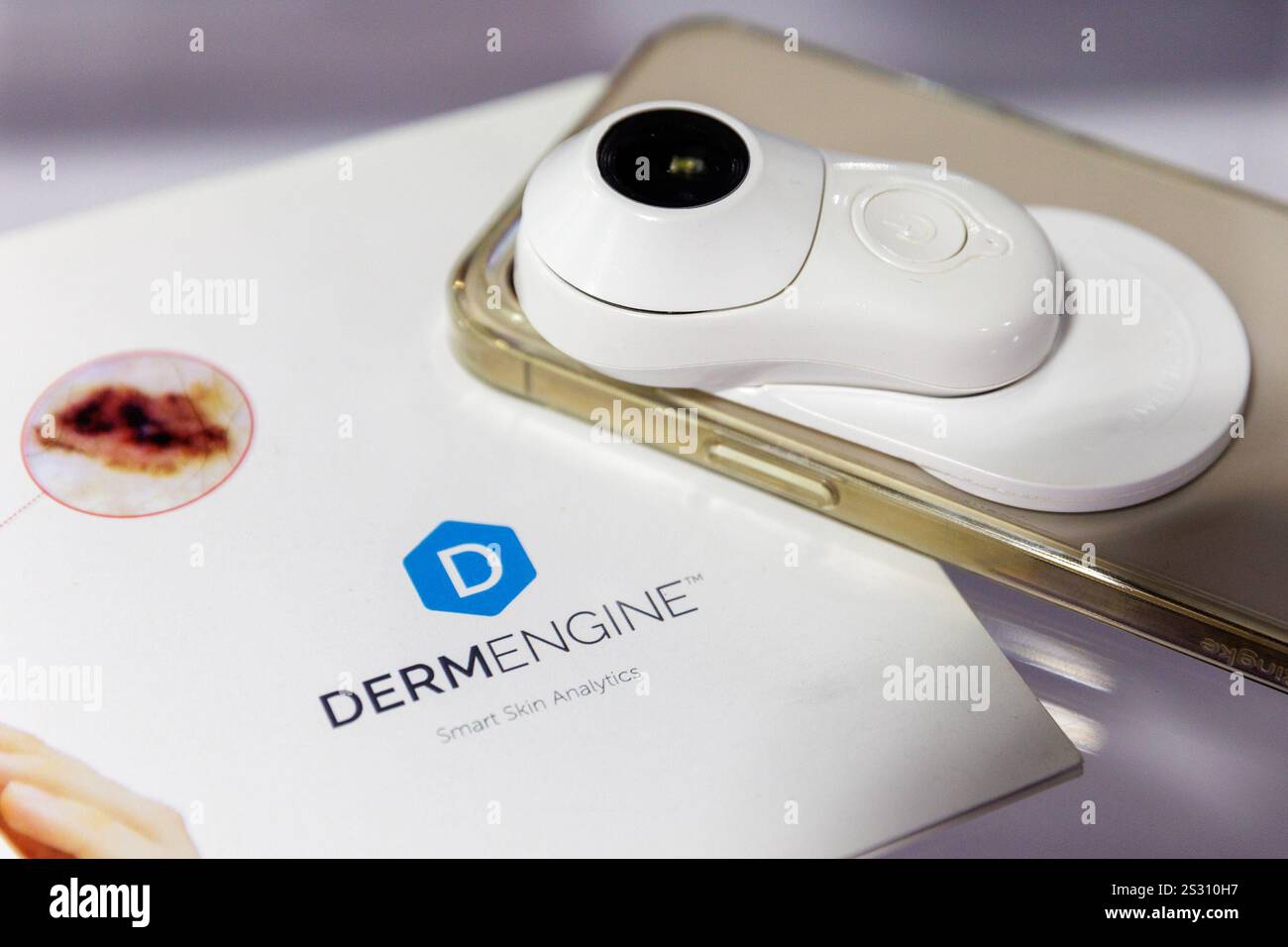 A Smart Skin Analytic device by Dermengine, on display during CES 2025 at the Venetian Resort in ...
