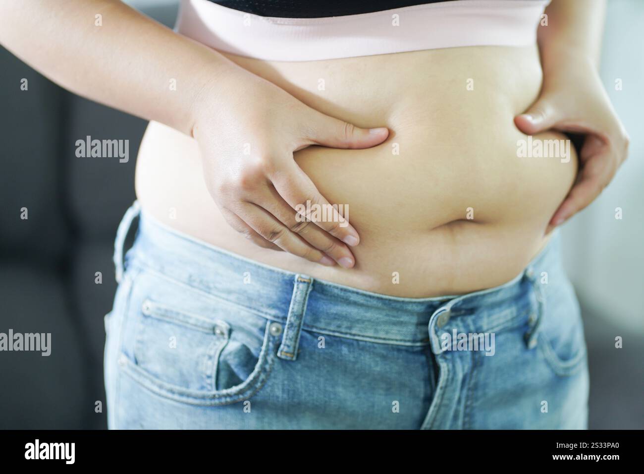 Obese Woman with fat upset about her belly. Overweight woman touching ...