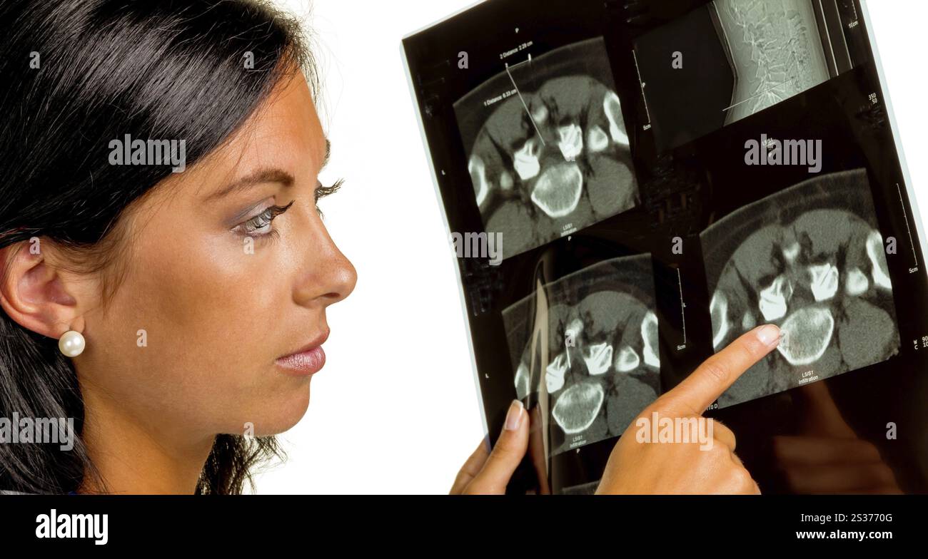 A doctor holds the X-ray image of an intervertebral disc infiltration ...