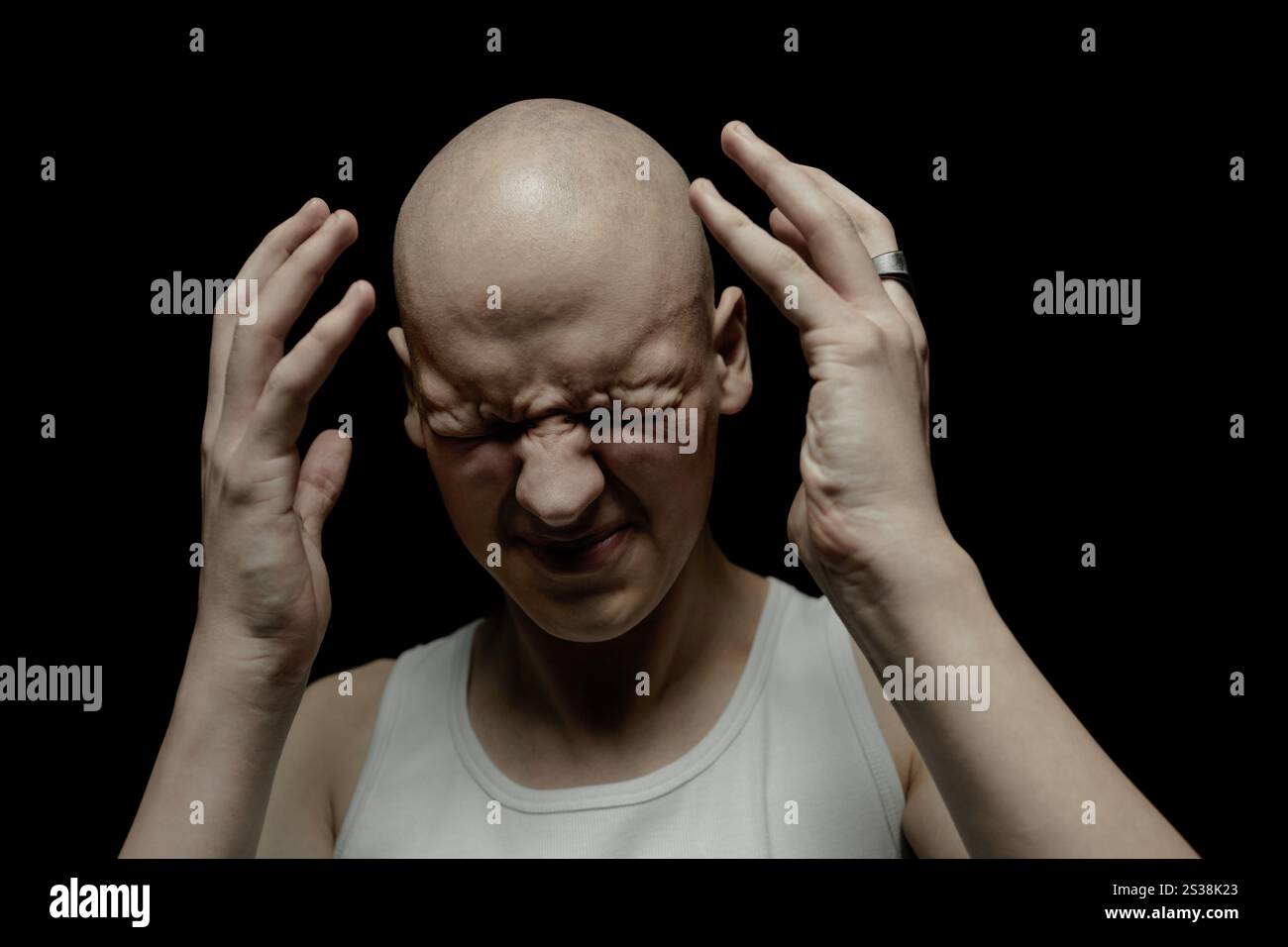 Portrait of bald man with screwed up face experiencing sudden intense ...