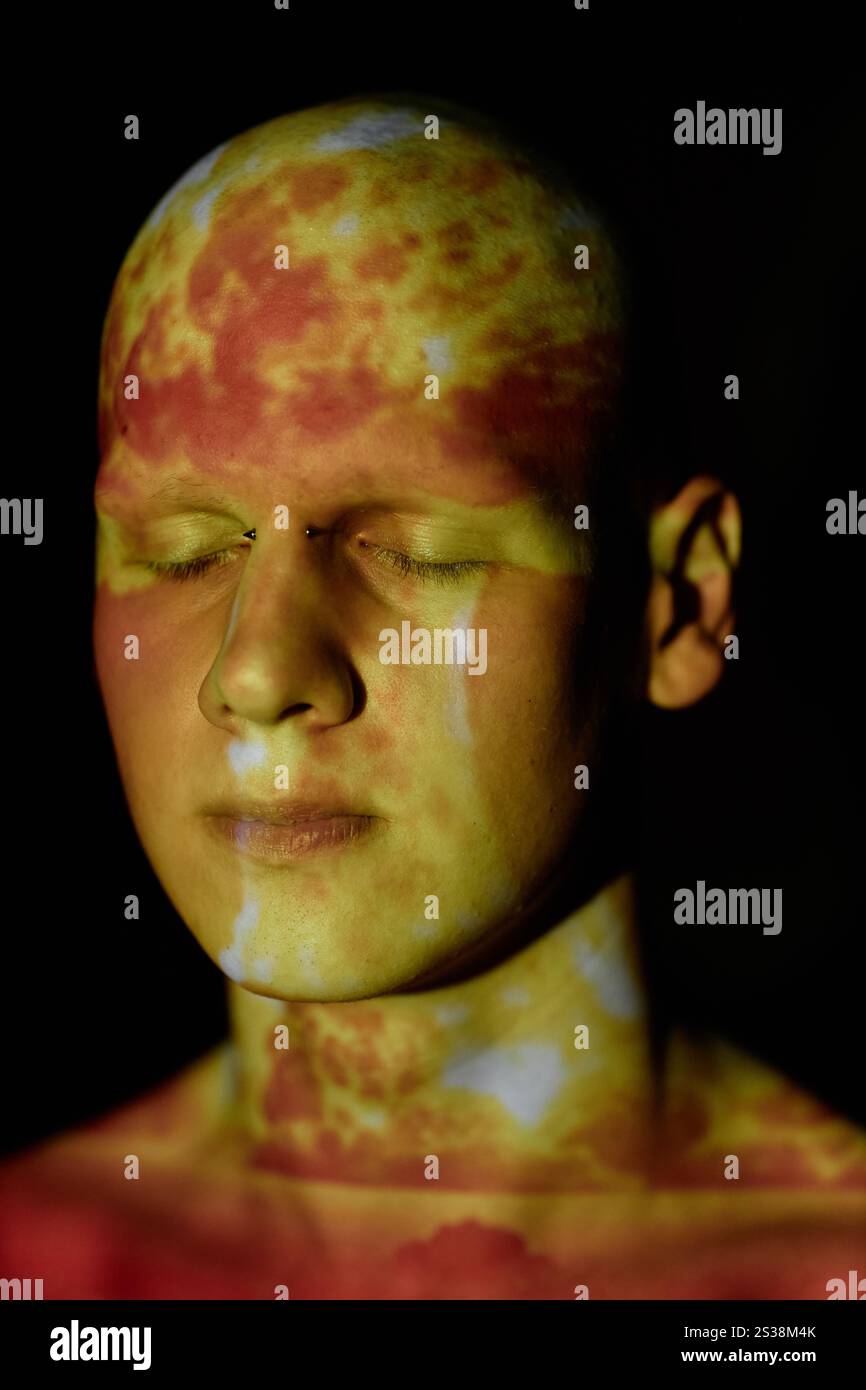 Vertical portrait of bald man with bridge nose piercing standing with ...