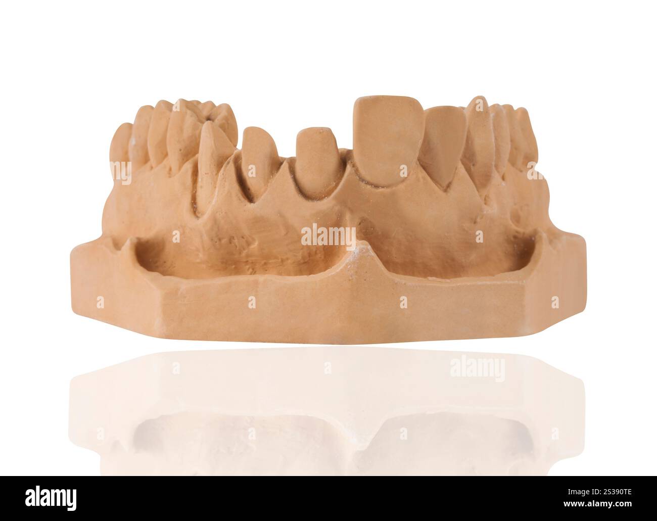 Gypsum model of jaw Stock Photo - Alamy