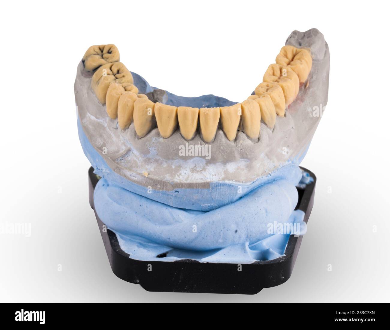 Gypsum model of human jaw isolated on white Stock Photo - Alamy