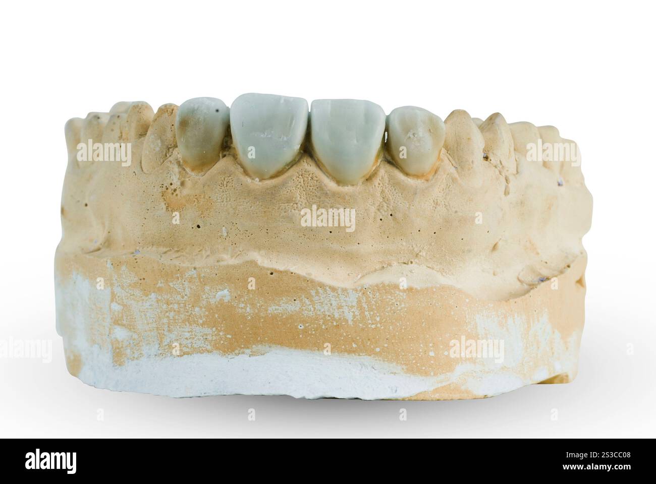 Gypsum model of human jaw isolated on white background Stock Photo - Alamy