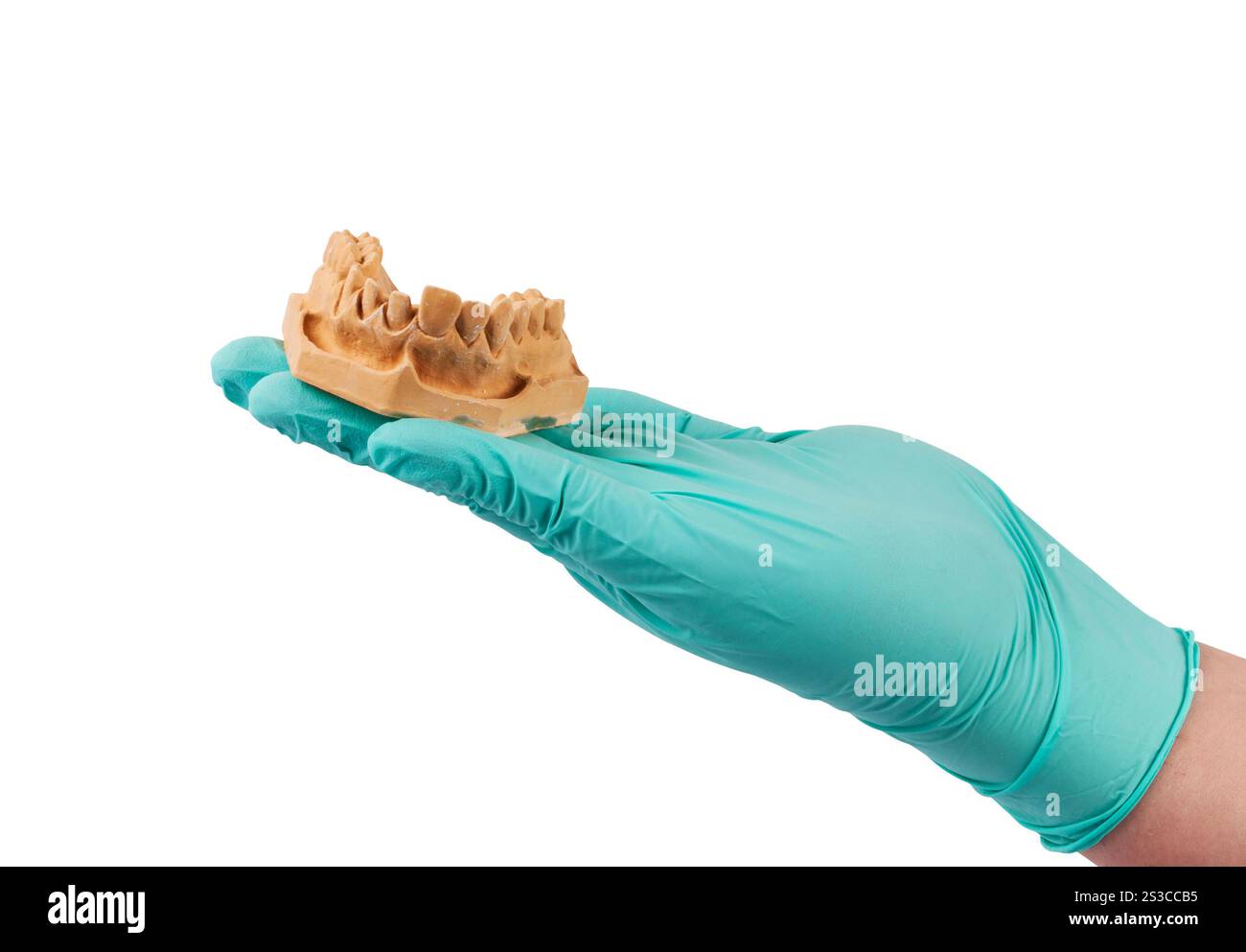 hand holding gypsum model of human jaw isolated Stock Photo - Alamy