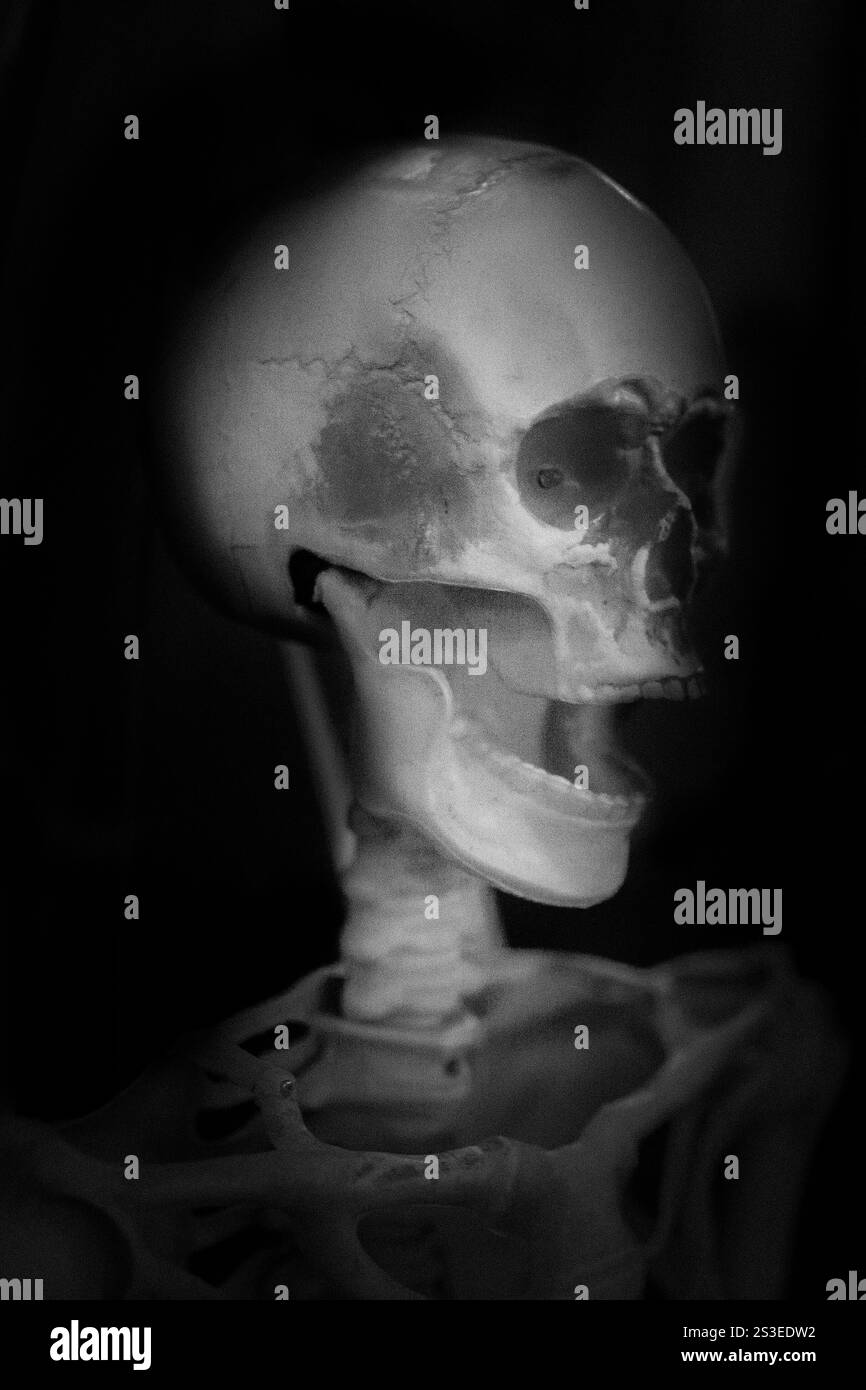 XRay Skull Skeleton Profile with Black Background Stock Photo - Alamy