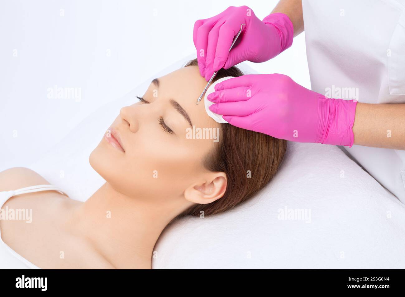 A procedure for cleansing the skin of the face from blackheads and acne ...