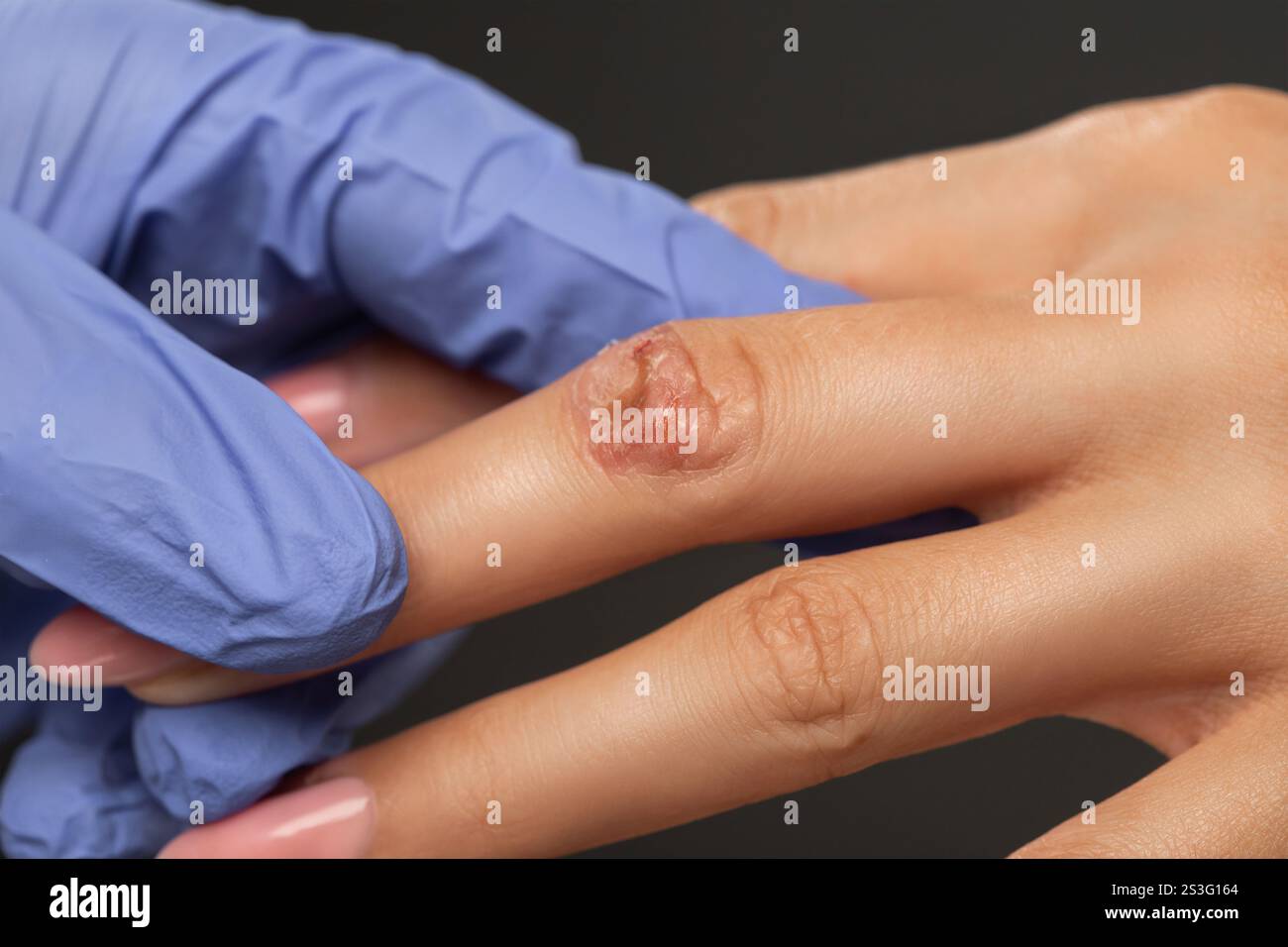 The doctor makes an examination of the wound on the woman's finger ...