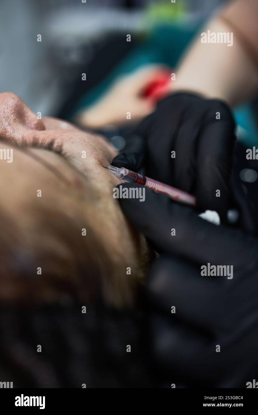 Cosmetic procedure with injection on face for beauty enhancement, black ...