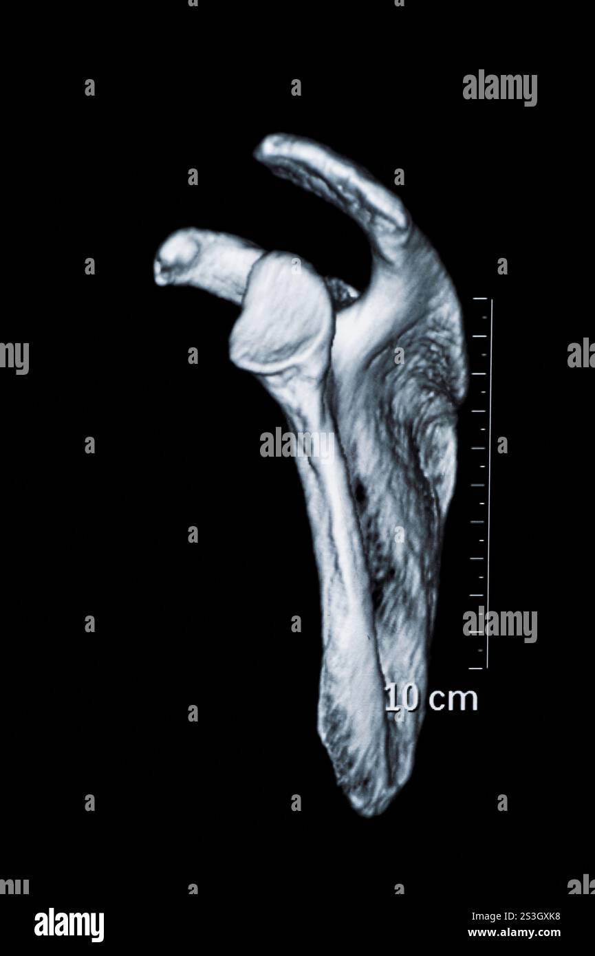 Human bone CT images Stock Photo - Alamy