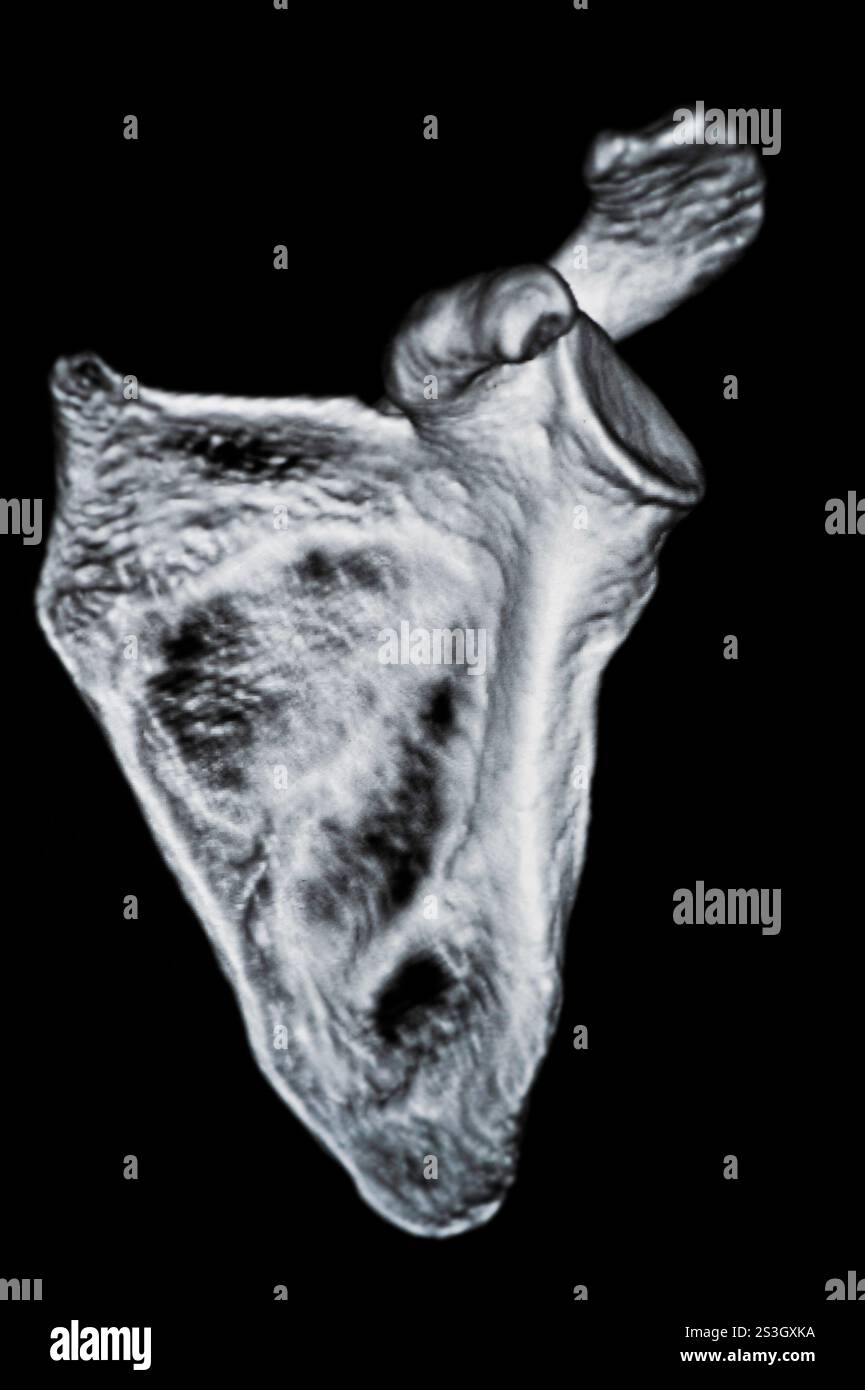Human bone CT images Stock Photo - Alamy