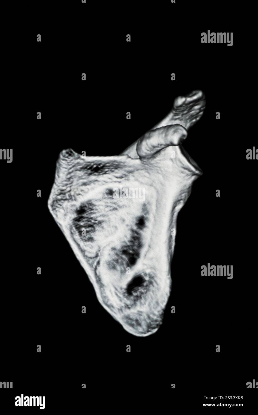 Human bone CT images Stock Photo - Alamy