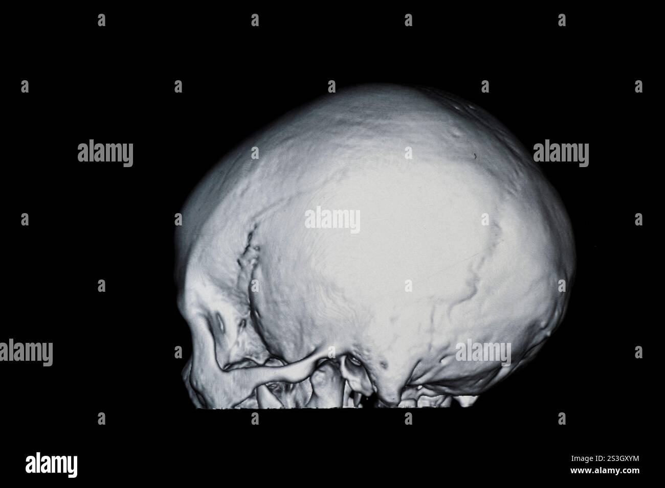 Human skull CT scans Stock Photo - Alamy