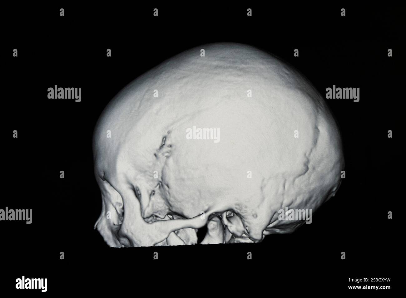 Human skull CT scans Stock Photo - Alamy