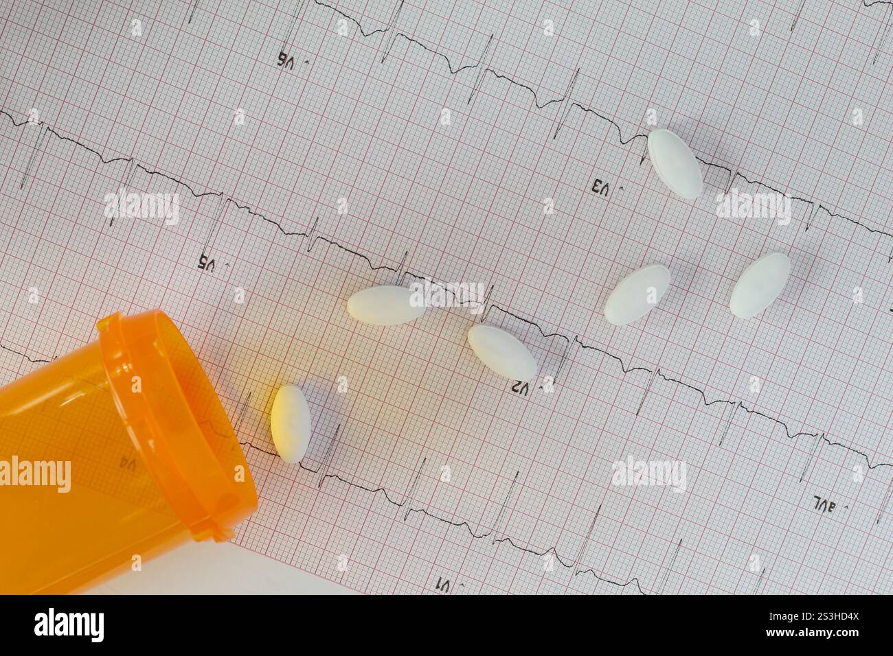 Electrocardiogram, ecg, ekg printed report graph with medication Stock ...