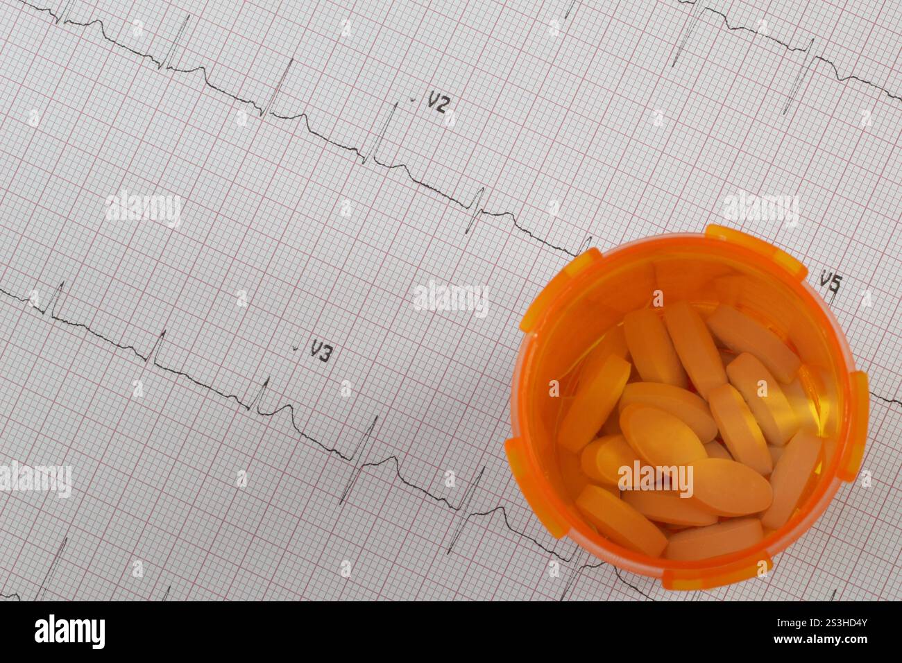 Electrocardiogram, ecg, ekg printed report graph with medication Stock ...