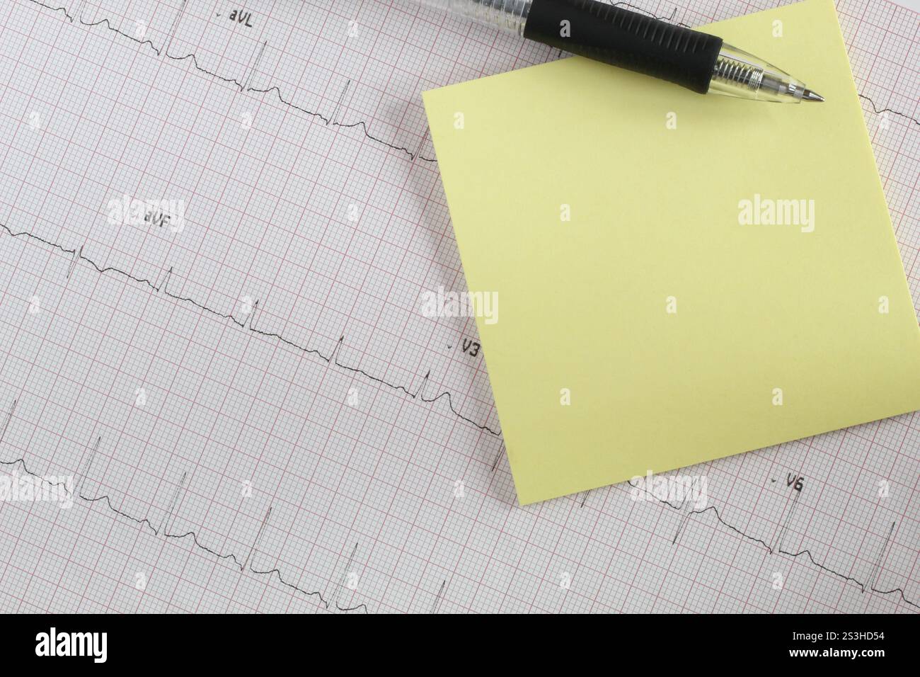 Electrocardiogram, ecg, ekg printed report with sticky note and pen ...