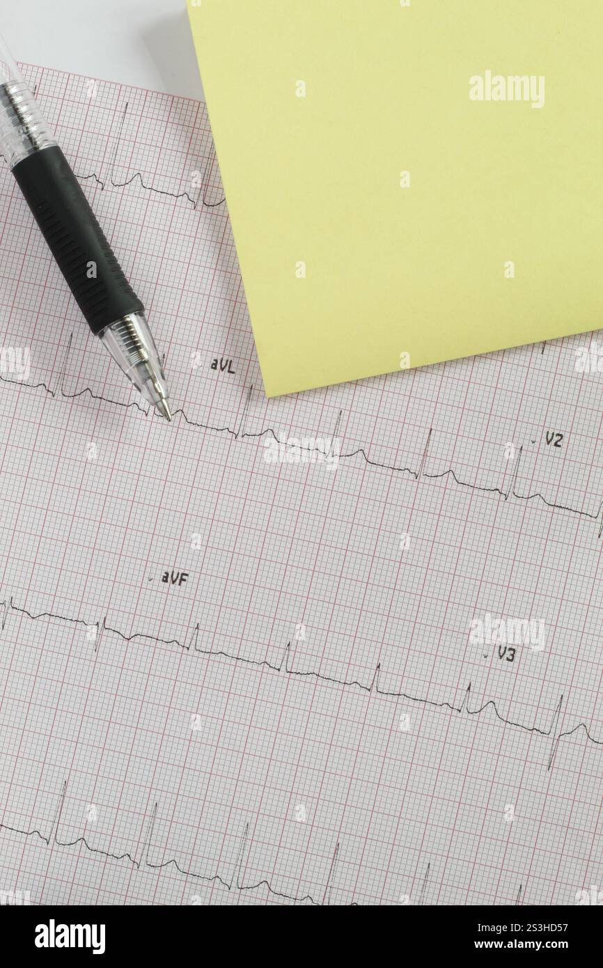 Electrocardiogram, ecg, ekg printed report with sticky note and pen ...