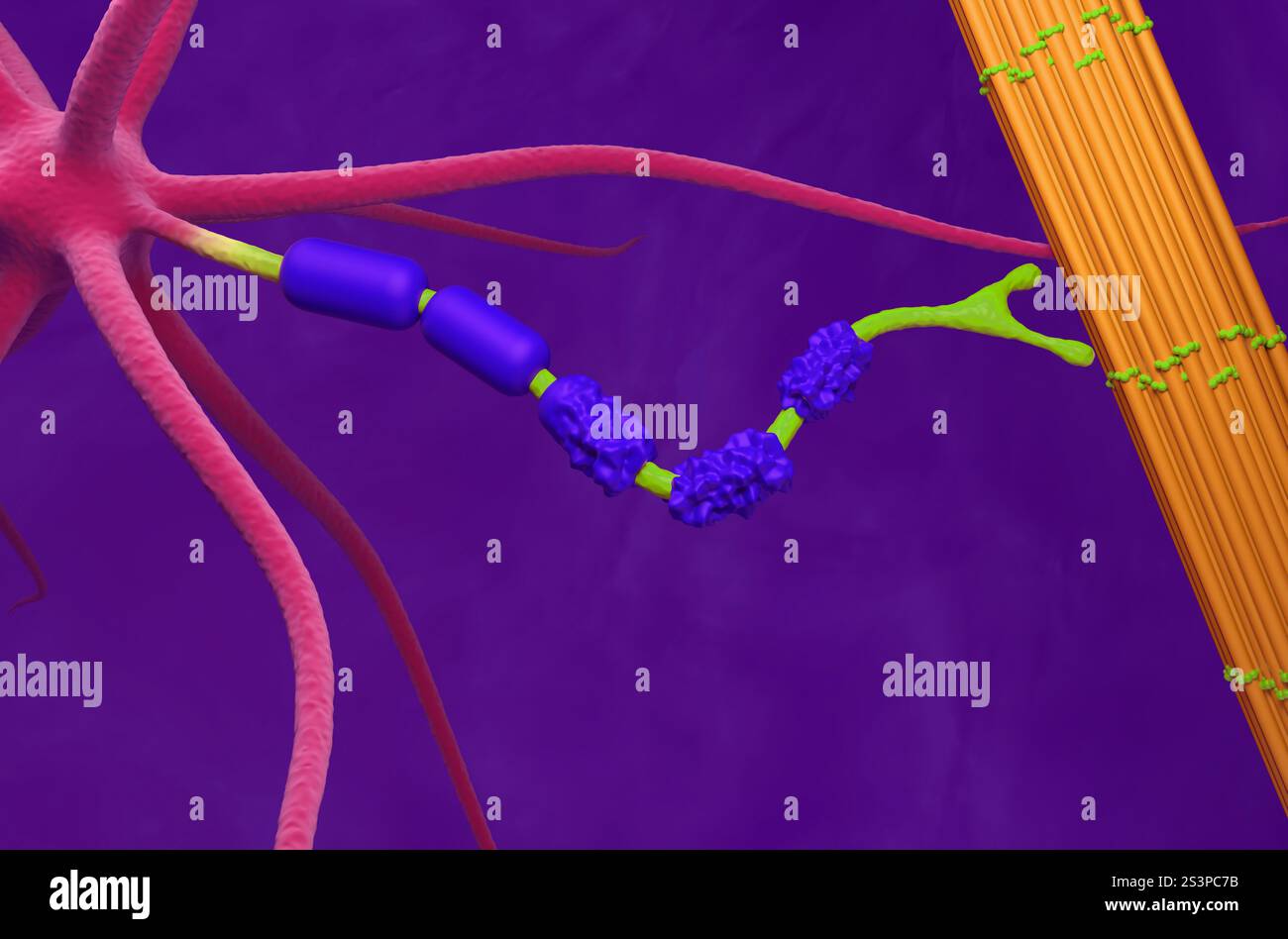 Motor neuron damaged by Amyotrophic Lateral Sclerosis (ALS) - 3d ...