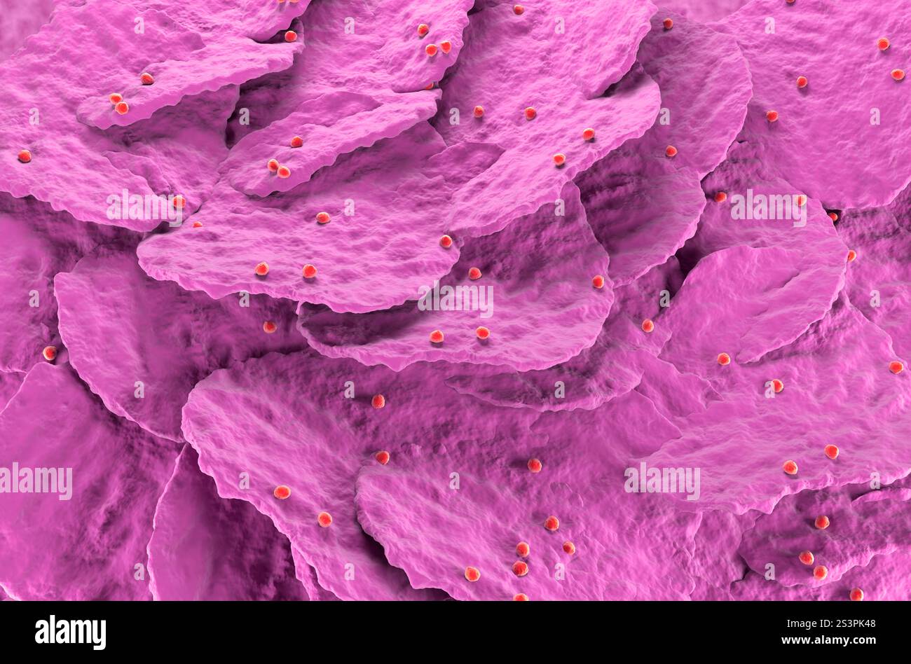Psoriasis skin surface - isometric view 3d illustration Stock Photo - Alamy