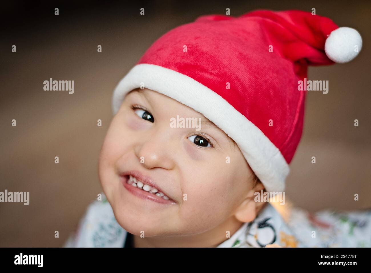 Portrait of a child with cerebral palsy looking at the camera. Special ...