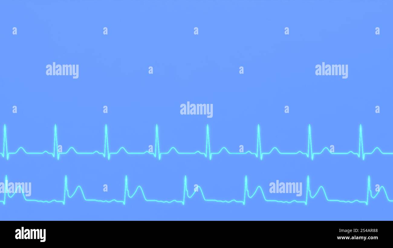 Medical ekg pulse rate animation hi-res stock photography and images ...