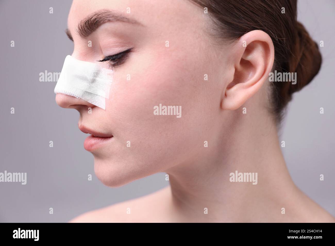 Woman with medical bandage on her nose after plastic surgery operation ...