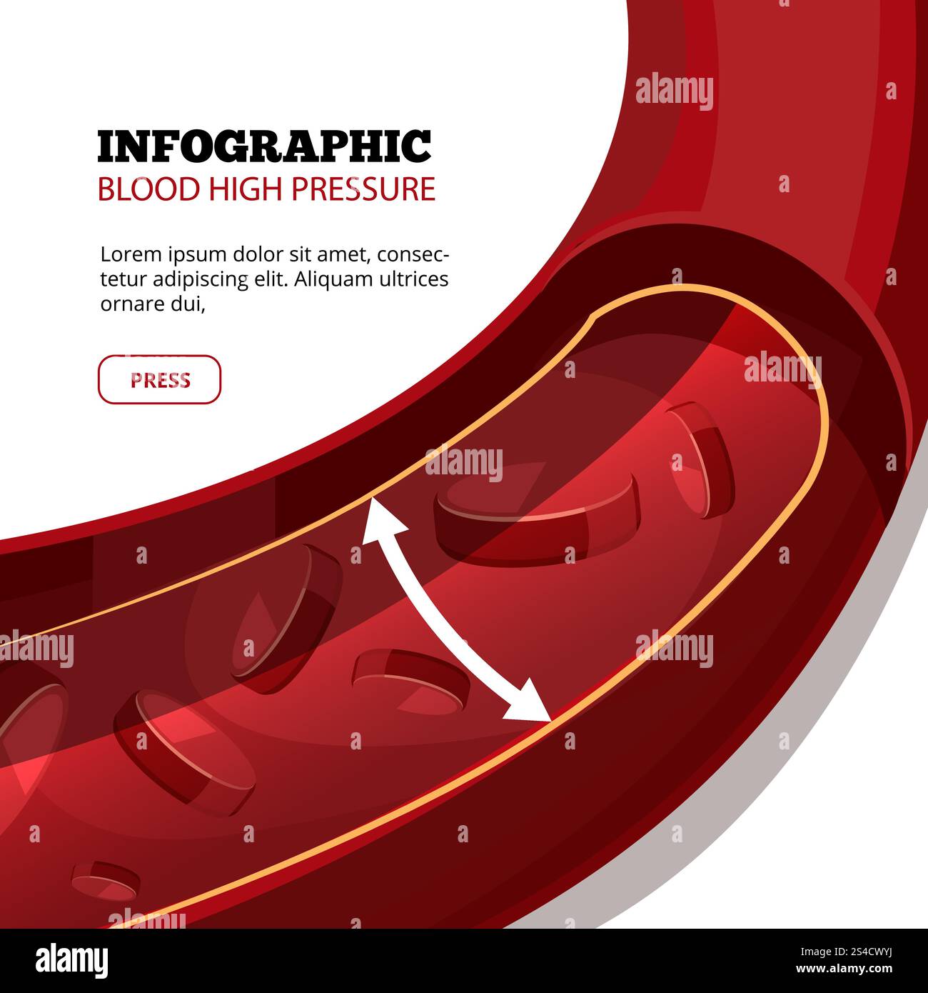 High blood pressure poster hi-res stock photography and images - Alamy