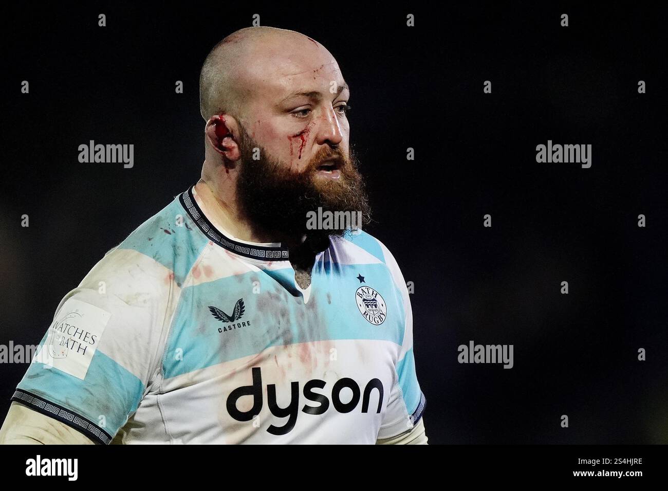 *EDITORS NOTE: Blood Shown* Bath's Tom Dunn during the Investec ...