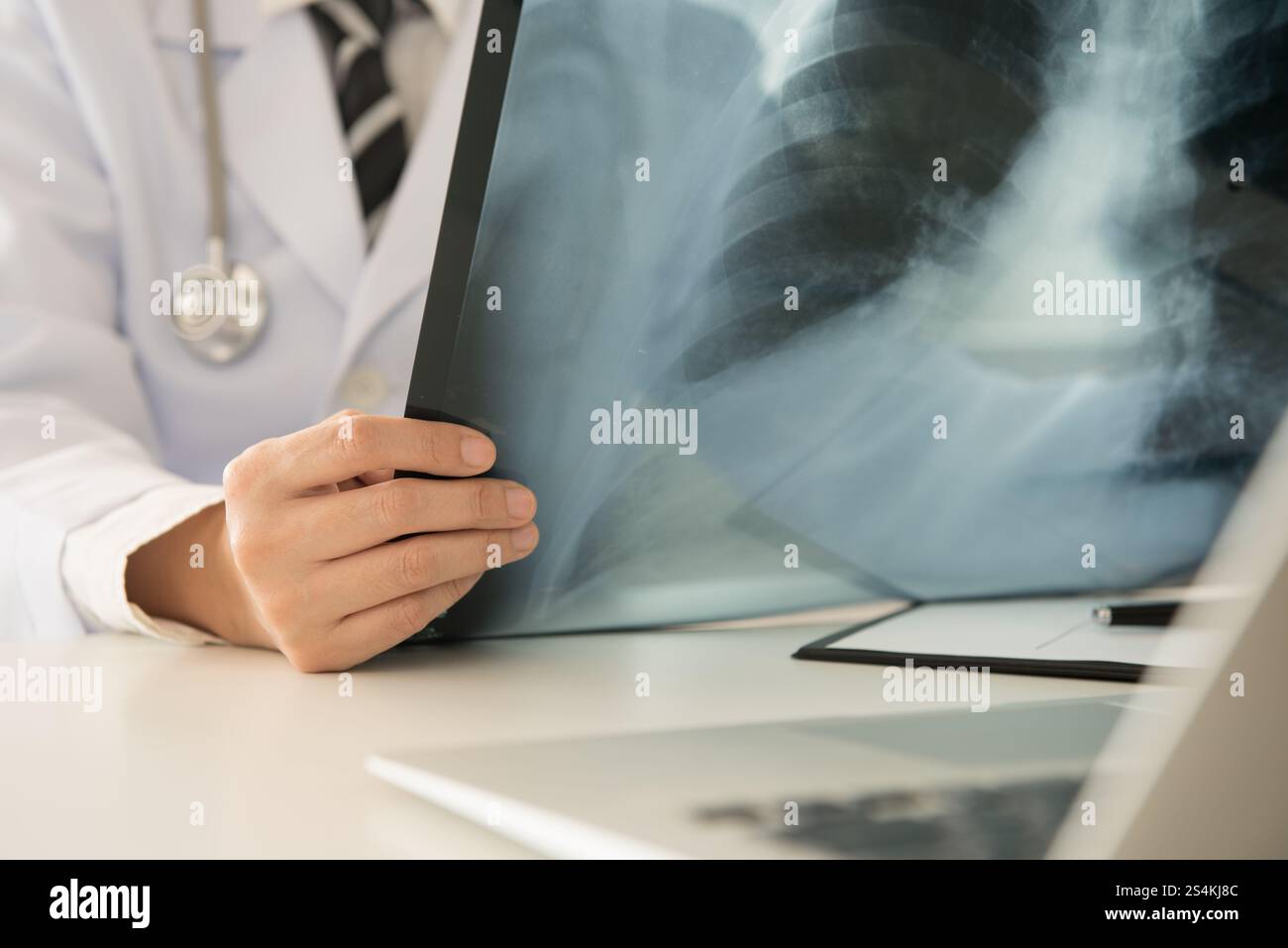 Doctor examining at lungs radiograph x-ray film of patient in roentgen ...